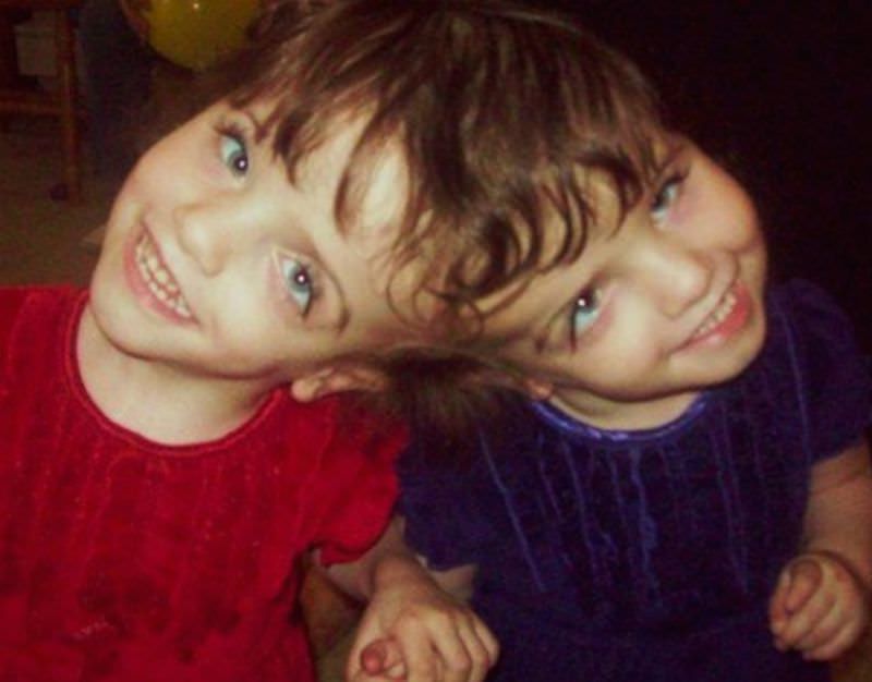 Estas Siamesas De 7 Años Te Dejarán Impresionado Con Sus Logros Y ...