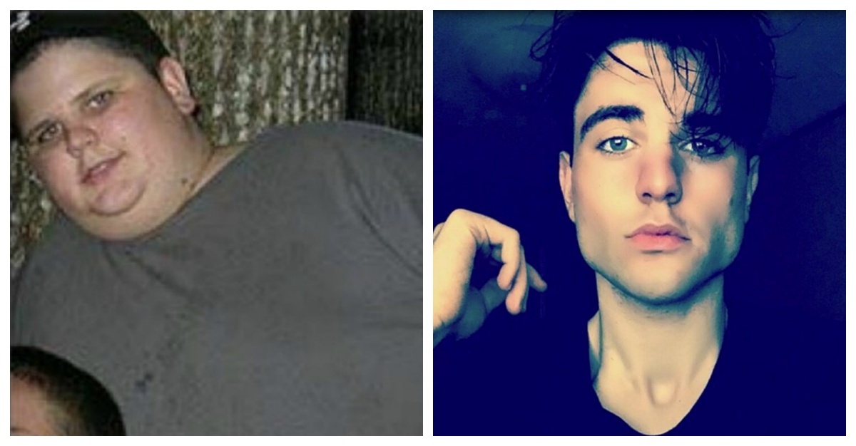Extraordinaria Transformación De Un Chico Que Pasó De Pesar 174 Kilos A ...