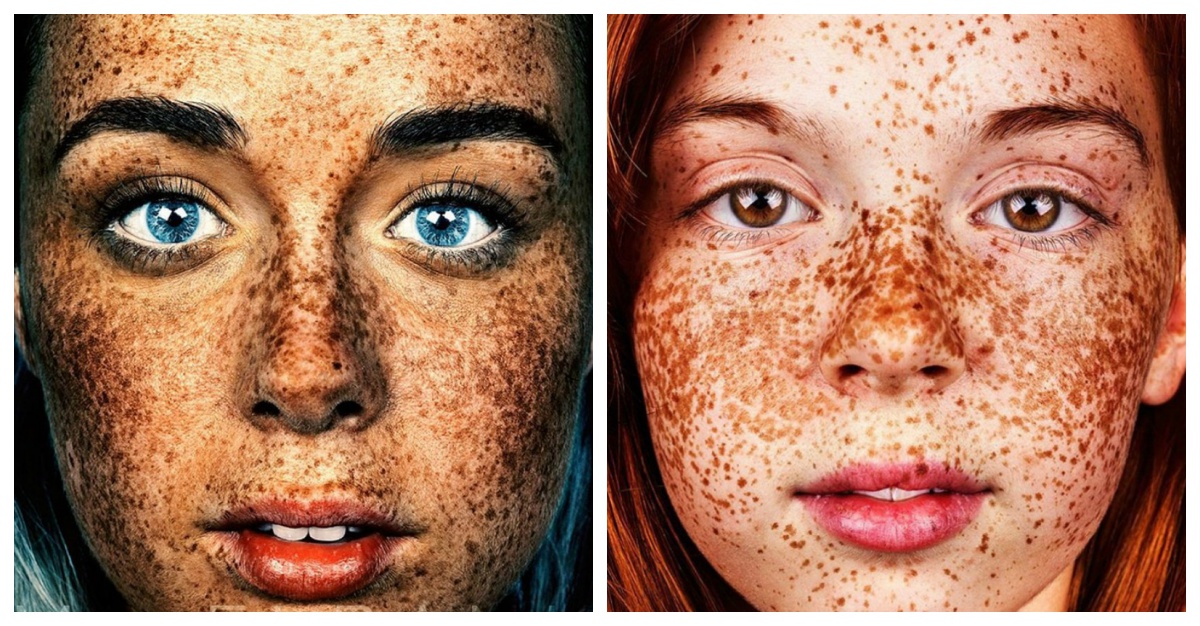 Fotógrafo Demuestra Que Las Pecas Otorgan Una Belleza Única A Quienes ...