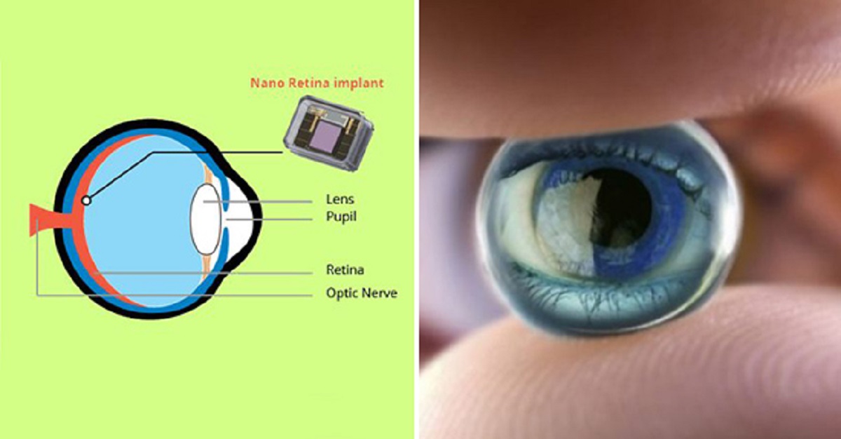 Ciegos Podrán Recuperar Su Visión Gracias A Una Nueva Bio-Retina | Tronya